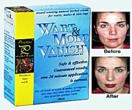 Pristine Herbal Touch Wart Mole Vanish Review – Skintagsgone.com