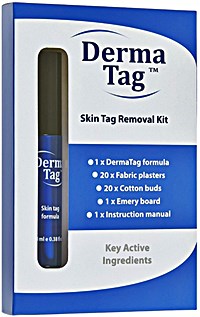 Top 3 Pain-Free Skin Tag Removal Products That Work (UK Only!)