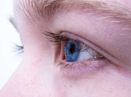 Treating Skin Tags Around the Eyes, on Eyelids, & Under Eyes at Home﻿